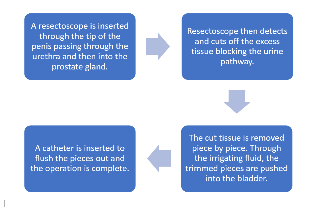 What is TURP Surgery? Things You Should Know.