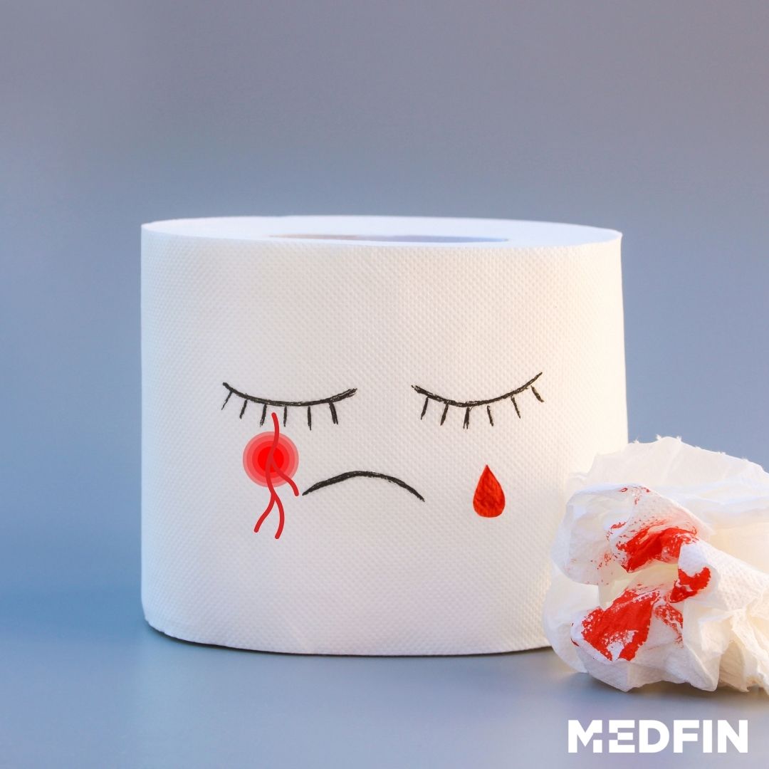 How To Diagnose Piles | Symptoms, Causes and Treatments - Medfin