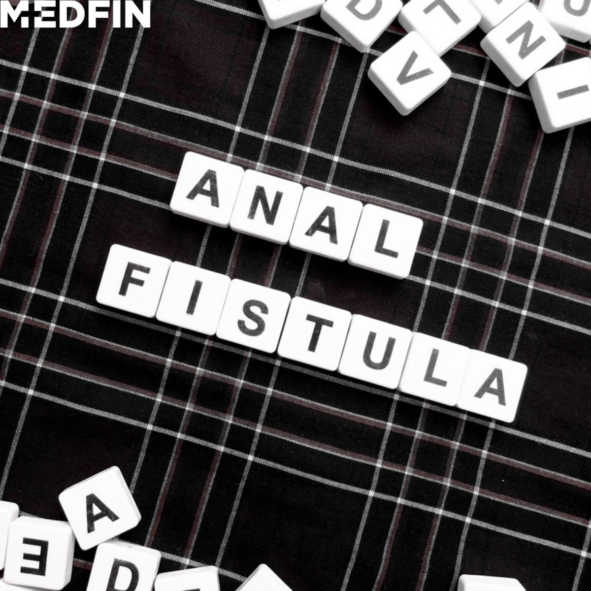What Is An Anal Fistula? Here's Everything You Need To Know About It