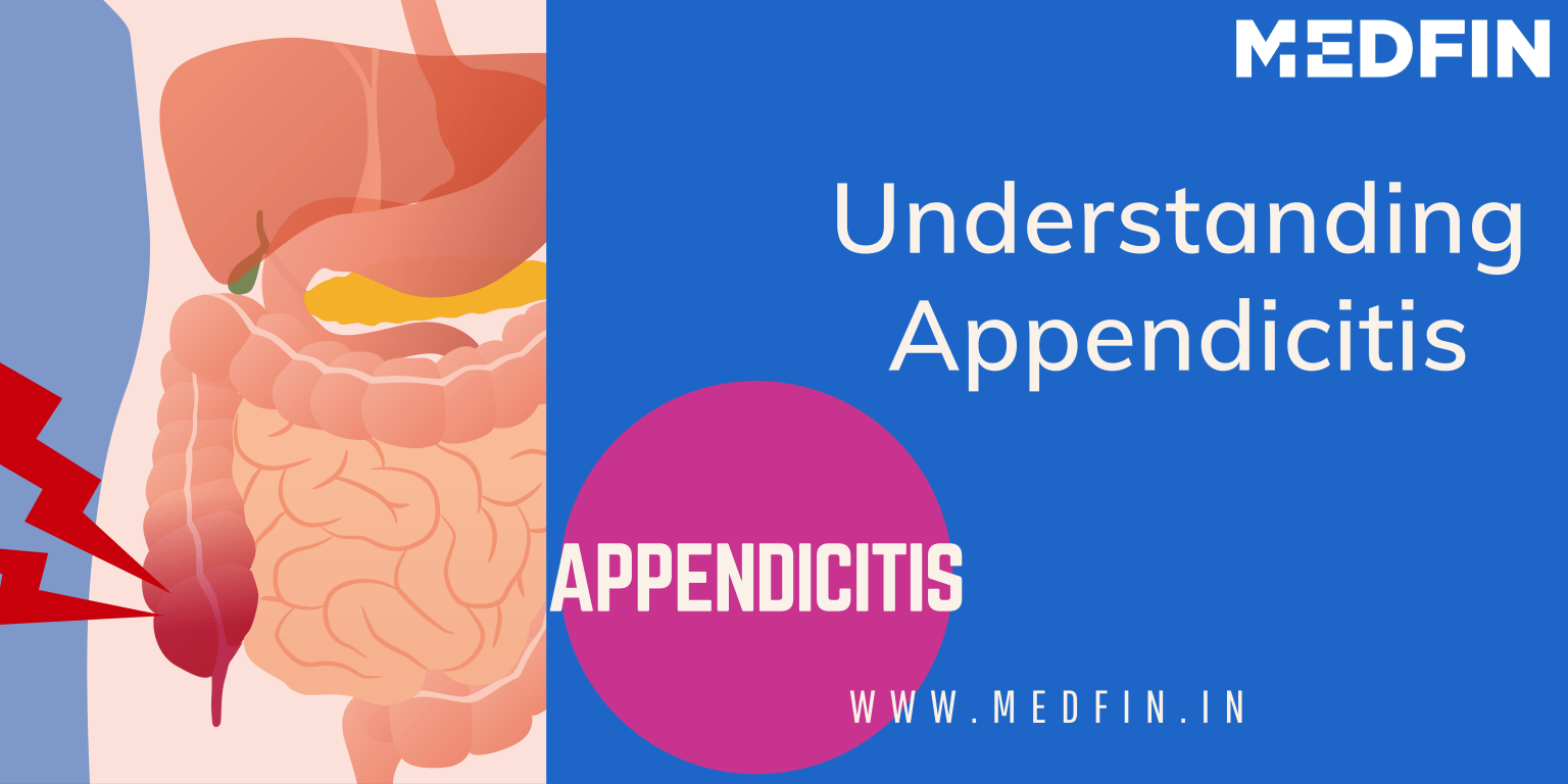 Appendicitis – Understanding The Disease - Medfin