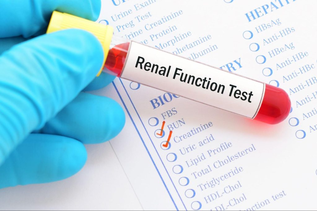 Understanding Kidney Function Test (KFT): Procedure, Types, and Purpose